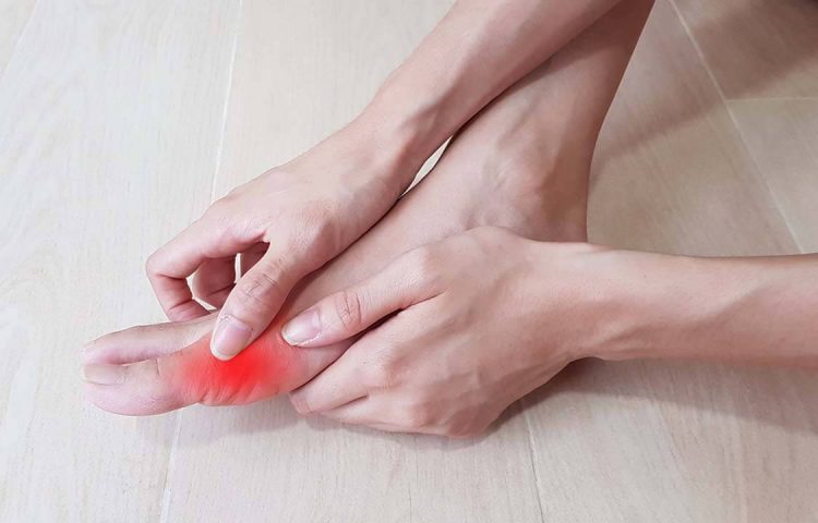 3 Causes of Gout That Makes Joint Pain | DonLego